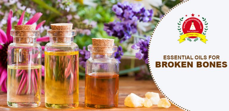 Top Essential Oils for Broken, Fractured Bones | Floral Essential Oils
